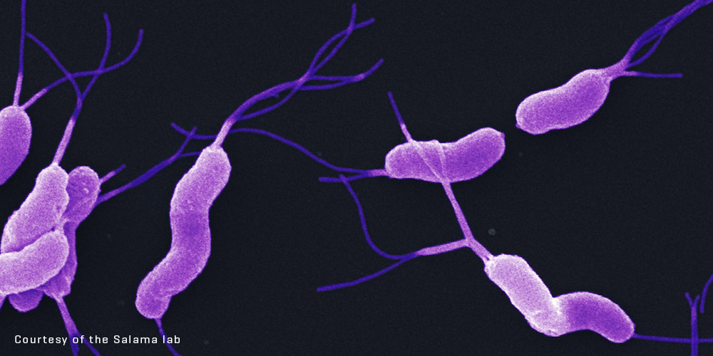 H. pylori test hints at risk factor for stomach cancer | Fred ...