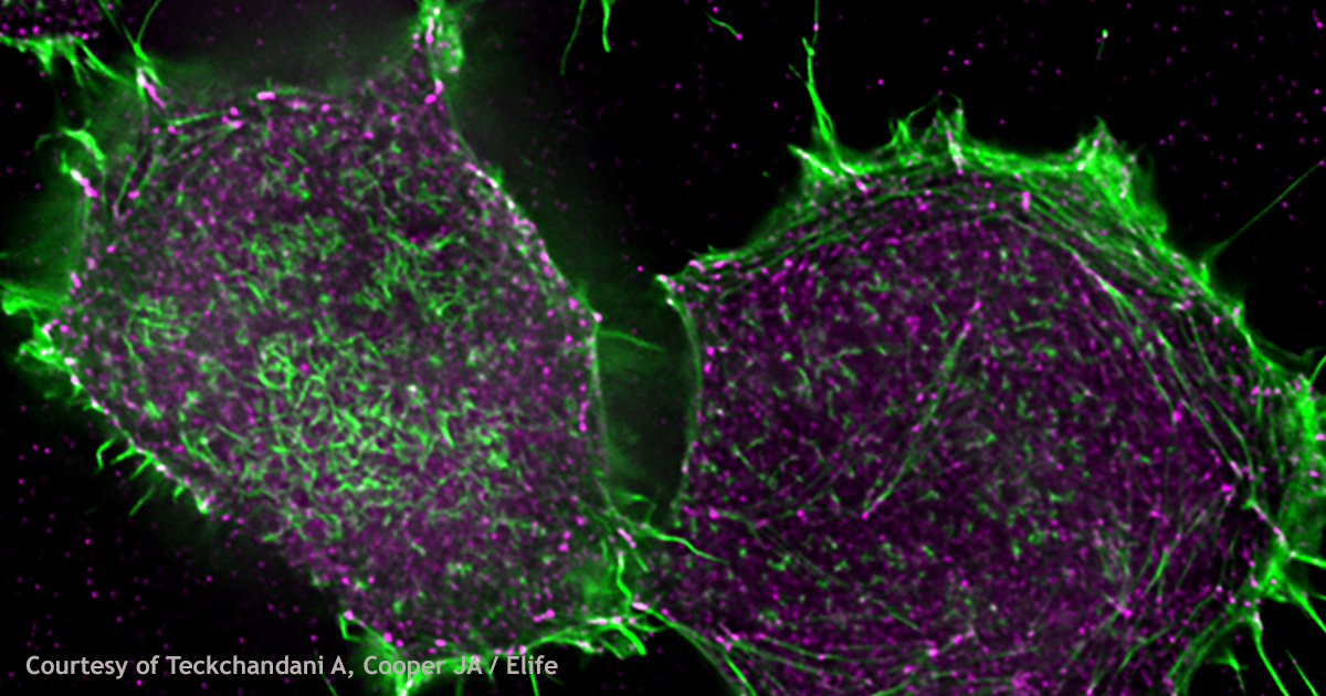 How cells sense and respond to the outside world