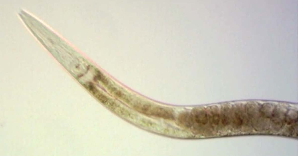 What can worms teach us about ourselves? | Fred Hutchinson Cancer Center