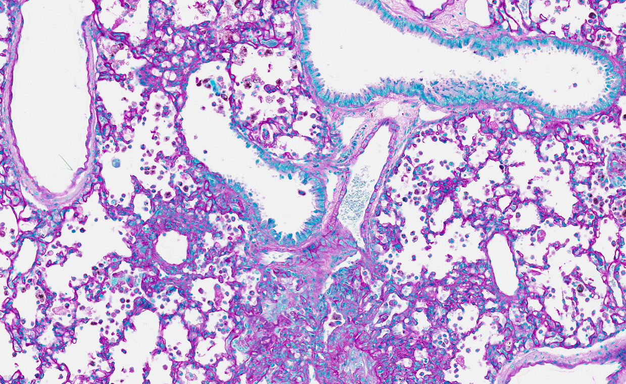 Fred Hutchinson Cancer Center