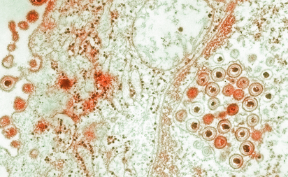 Engineered HSV can trigger genetic chain reaction, rejigger HSV genes ...