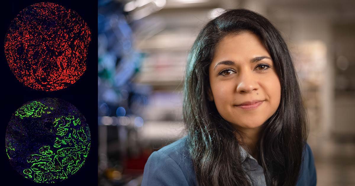 Two Fred Hutch studies identify pancreatic cancer biomarker driving ...