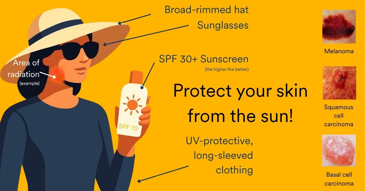 Had radiation? Protect your skin from the sun! - Fred Hutch