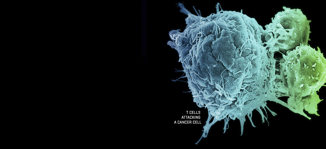 What's your cancer color?