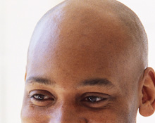 Bald is beautiful—and cancer-protective | Fred Hutchinson Cancer Center