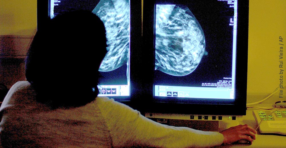 New screening study causes more mammogram confusion | Fred Hutchinson ...