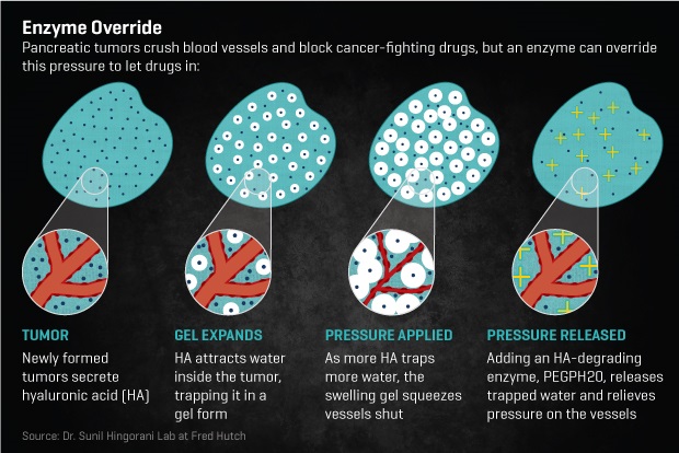 Internal pressure makes pancreatic tumors hard to treat | Fred Hutchinson Cancer Center