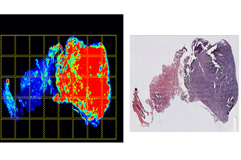 Tumor Paint approved for first U.S. trial | Fred Hutchinson Cancer Center
