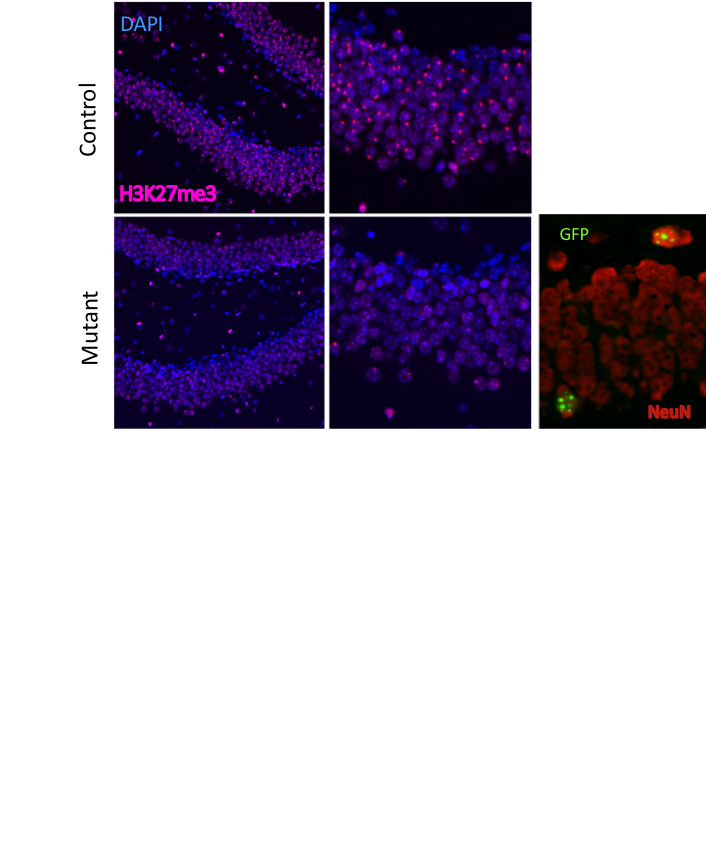 Understanding the genetics of X chromosome inactivation | Fred ...