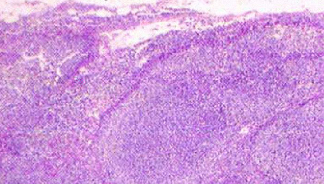 Cancers | Fred Hutchinson Cancer Center