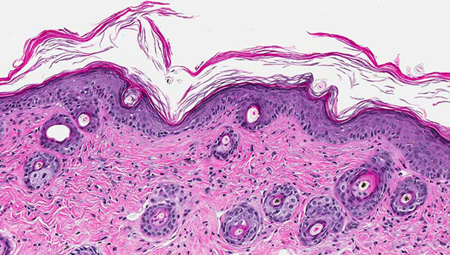 Cancers | Fred Hutchinson Cancer Center