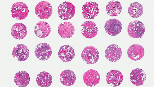 Specialized Pathology | Fred Hutchinson Cancer Center