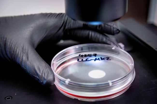 ImmunOptimize Network - Fred Hutch