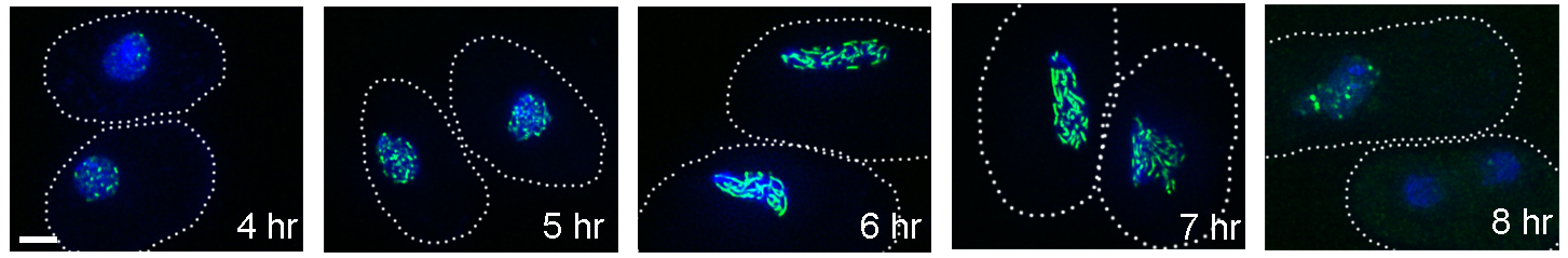 Taking a closer look at DNA double-strand break hotspots | Fred ...