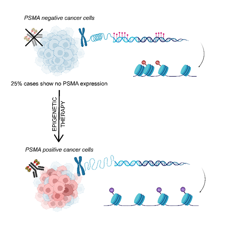Interrogating heterogeneous PSMA expression in advanced prostate cancer ...