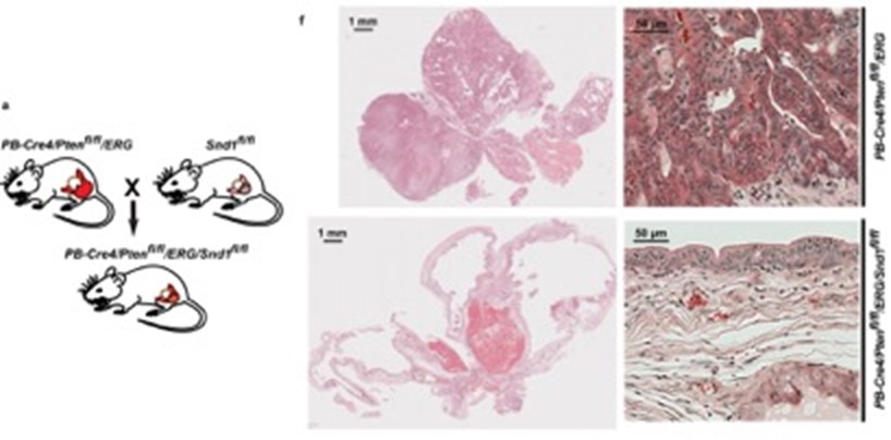 SND1 is required for ERGonomic growth of prostate tumors | Fred ...