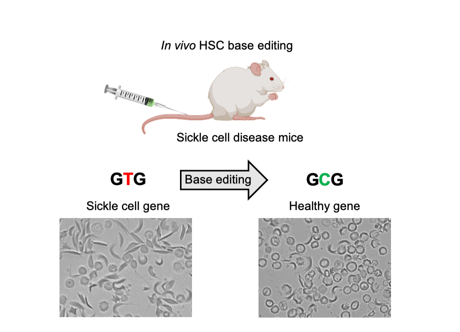 Towards accessible gene therapy: in vivo base editing to cure Sickle ...