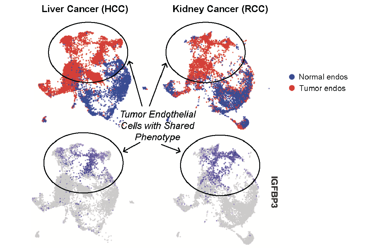 TEC specs: tumor endothelial cells in renal cell carcinoma | Fred ...