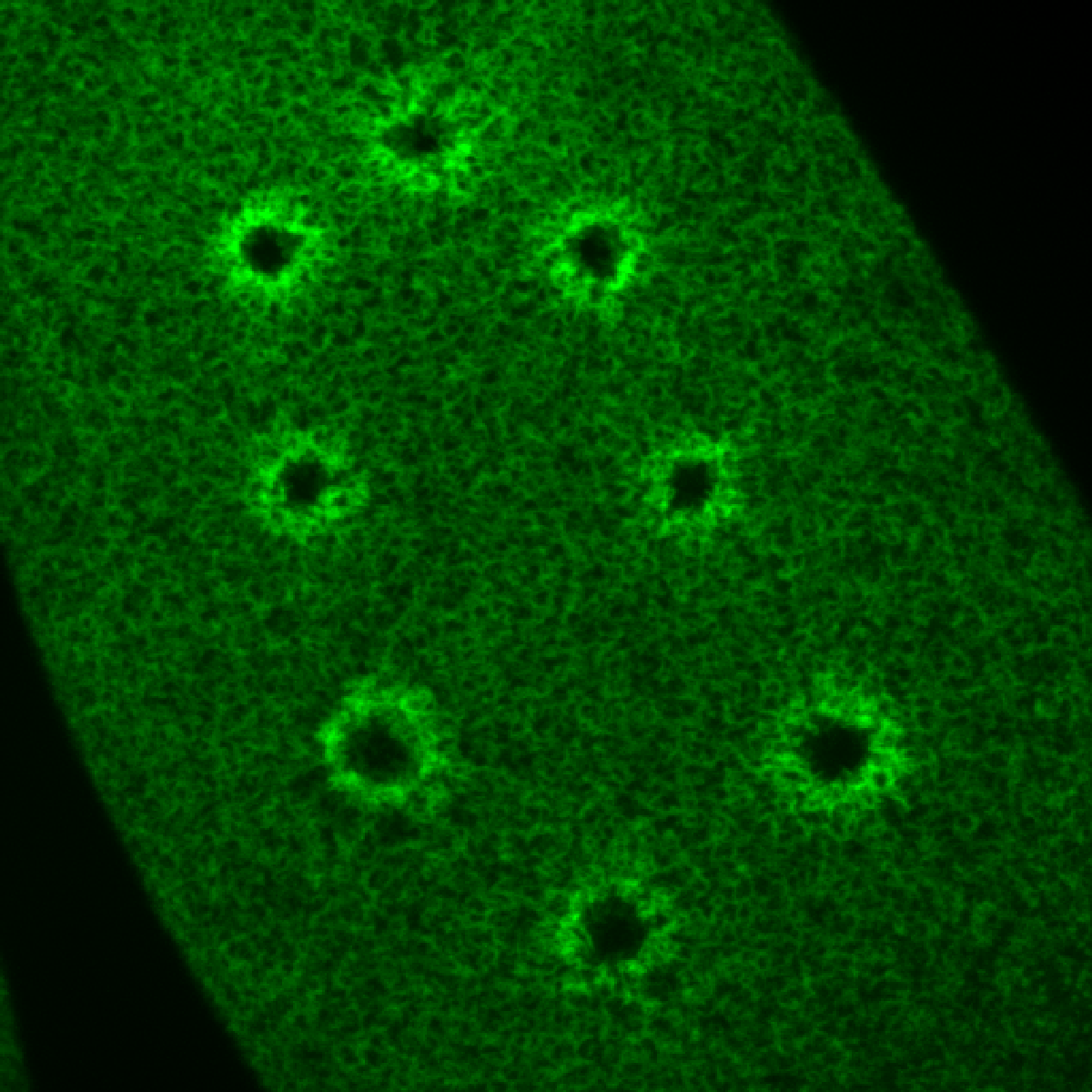 Beyond diabetes: the insulin pathway’s key role in cellular wound ...