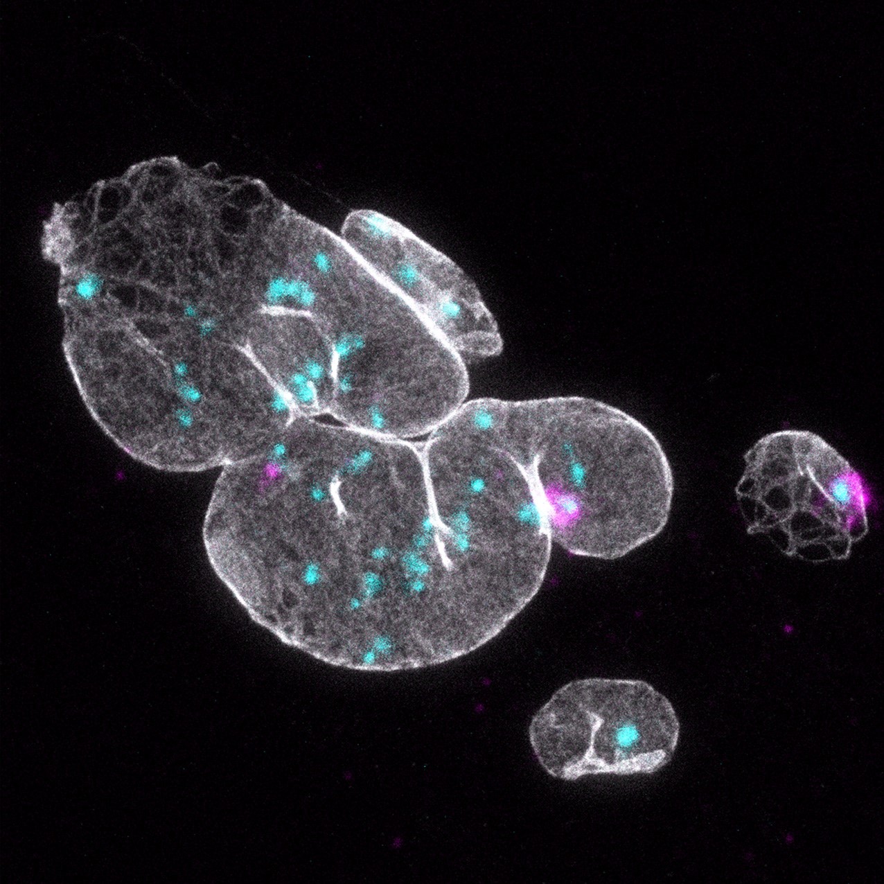 Chromosomes take fate into their own hands during micronucleus rupture ...