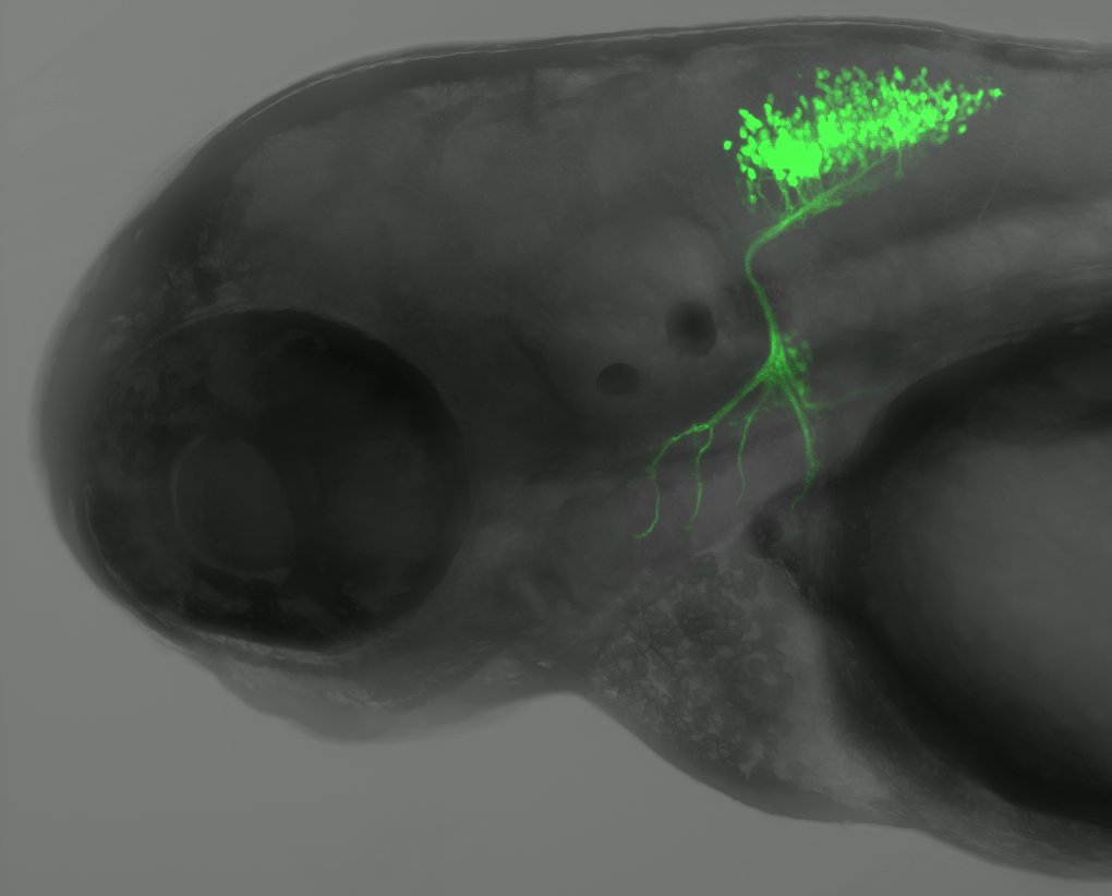 Don’t lose your nerve: choosing the right path during axon regeneration ...