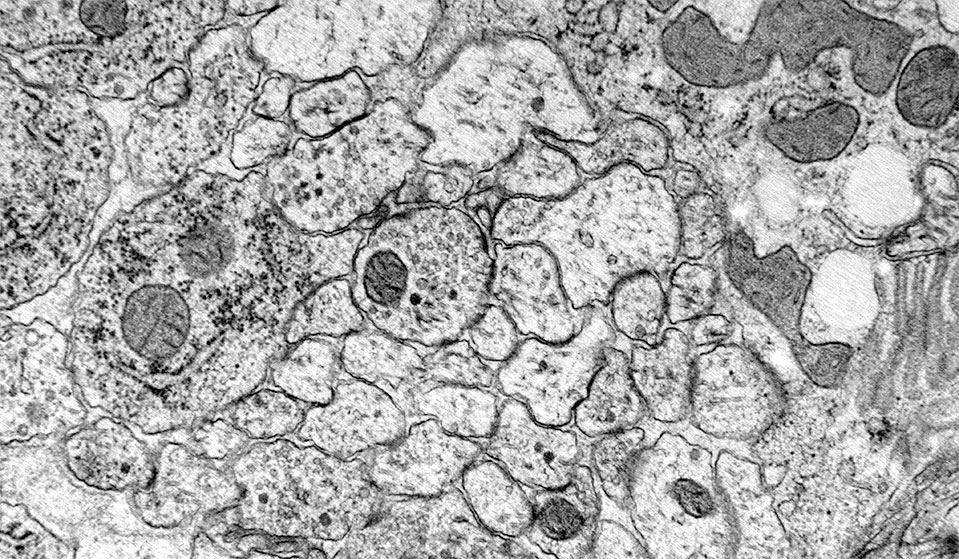 Electron Microscopy | Fred Hutchinson Cancer Center