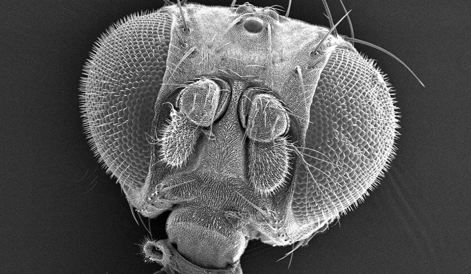 Electron Microscopy | Fred Hutchinson Cancer Center