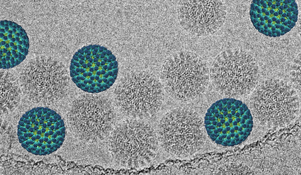 Electron Microscopy | Fred Hutchinson Cancer Center