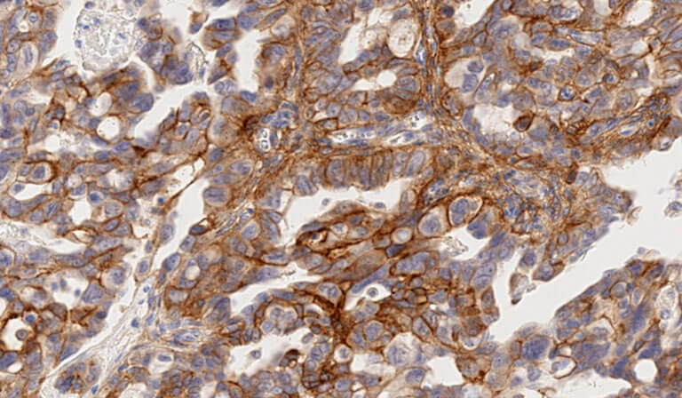 Experimental Histopathology: IHC/ISH/Multiplex Services | Fred ...