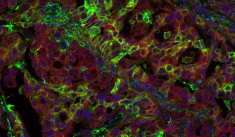 Experimental Histopathology: IHC/ISH/Multiplex Services | Fred ...