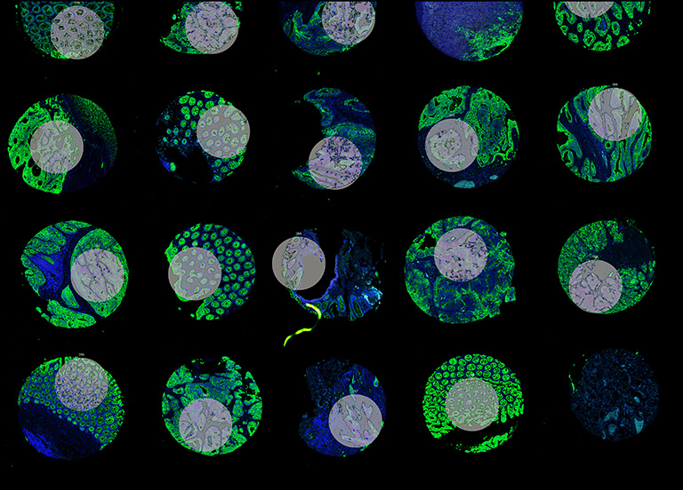 Experimental Histopathology: Spatial Biology Services - Fred Hutch