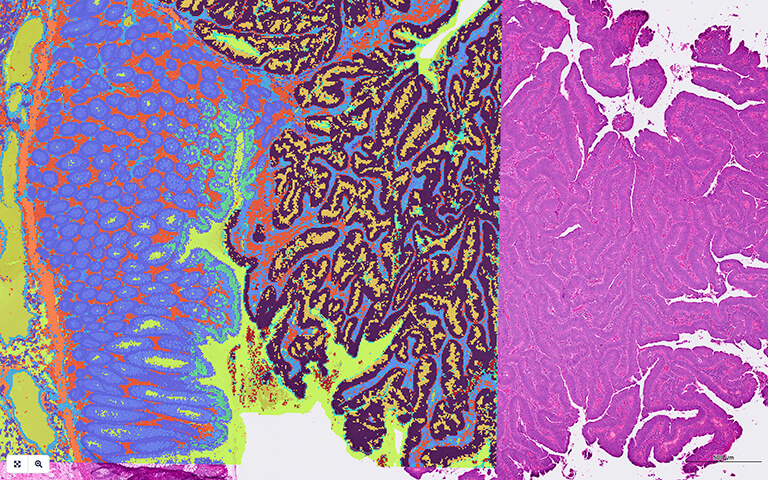 Experimental Histopathology: Spatial Biology Services - Fred Hutch