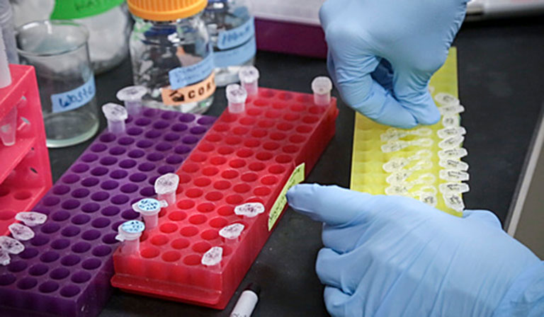 Proteomics & Metabolomics | Fred Hutchinson Cancer Center