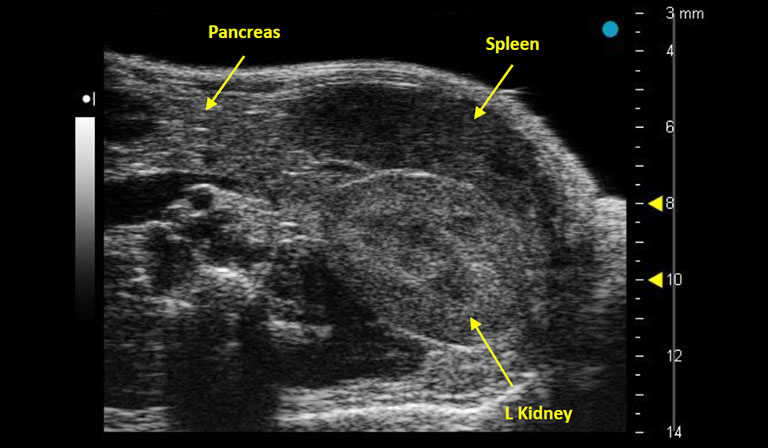 Pancreas Ultrasound Labeled