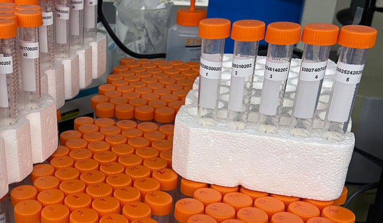 Clinical Research Specimen Processing: Services | Fred Hutchinson ...