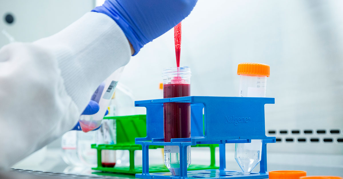 Biospecimen Processing and Biorepository: Services | Fred Hutchinson ...