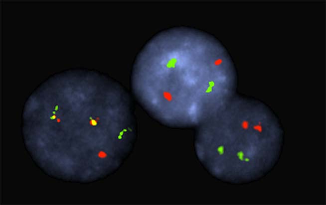 Clinical Cancer Genomics Laboratory | Fred Hutchinson Cancer Center