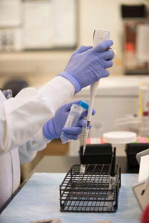 Busulfan Lab (Pharmacokinetics Lab) | Fred Hutchinson Cancer Center