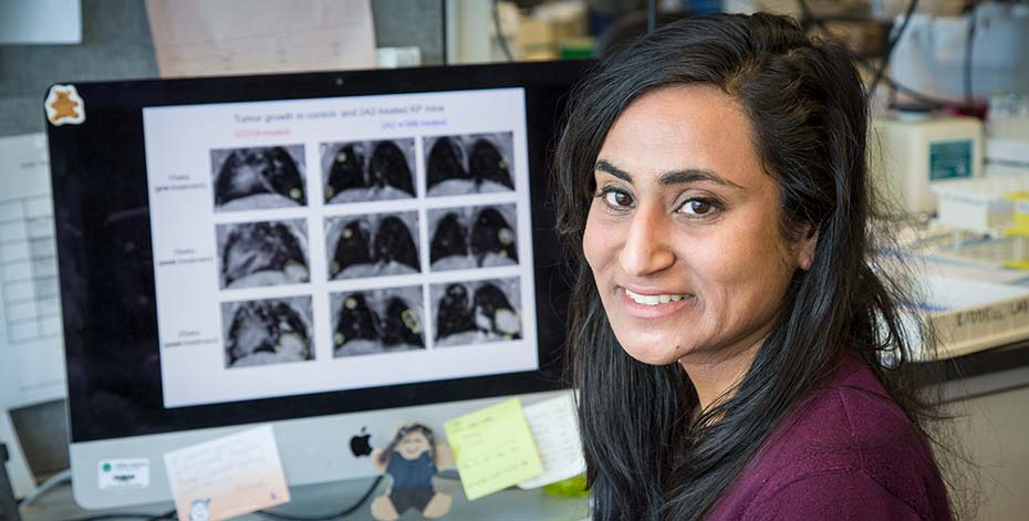 Spotlight on Shivani Srivastava | Fred Hutchinson Cancer Center