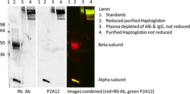 Mouse Hybridoma Clone P2A12 Against Human Haptoglobin Alpha 2 Chain ...