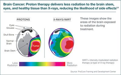 Seattle Cancer Care Alliance Proton Therapy Center opens for tours ...