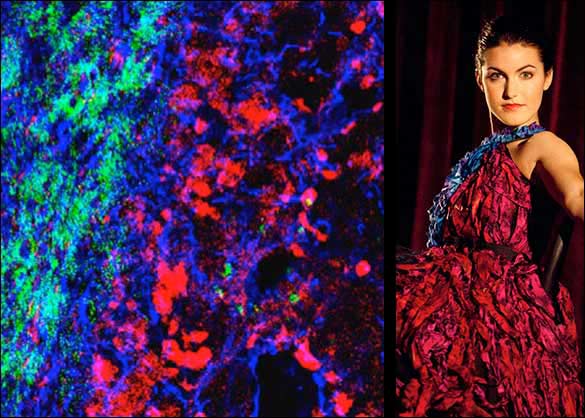 Cancer couture | Fred Hutchinson Cancer Center