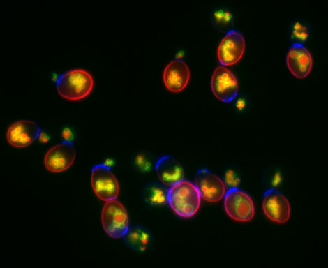 Long-term hoarding of cellular ‘garbage’ could trigger old age | Fred ...