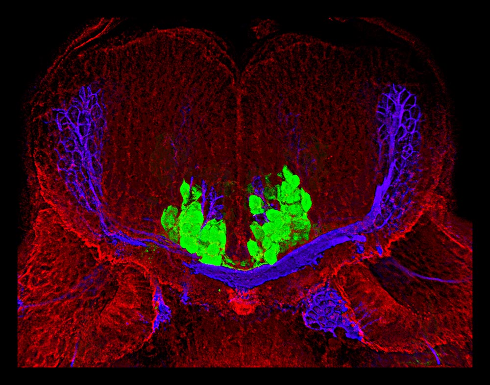 Where science meets art | Fred Hutchinson Cancer Center