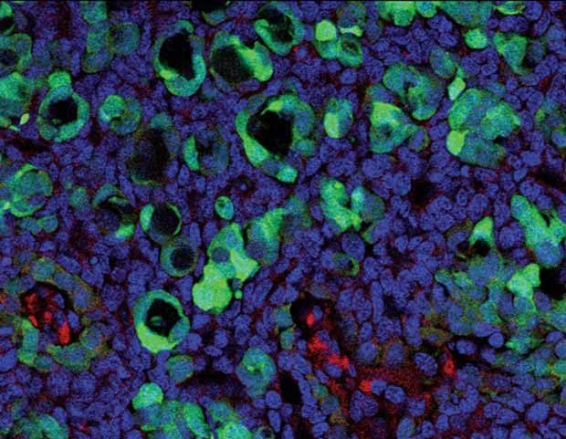 Where science meets art | Fred Hutchinson Cancer Center