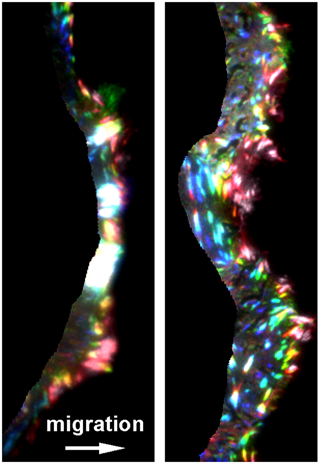 The molecules that drive cell movement | Fred Hutchinson Cancer Center