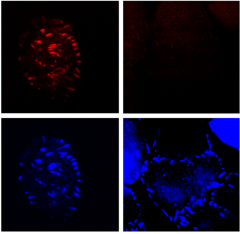 The molecules that drive cell movement | Fred Hutchinson Cancer Center