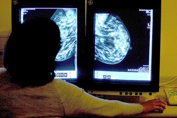 New screening study causes more mammogram confusion - Fred Hutch
