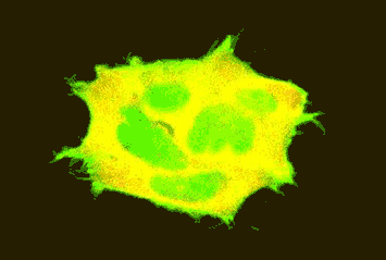 How one protein helps cancer both spread and grow | Fred Hutchinson ...