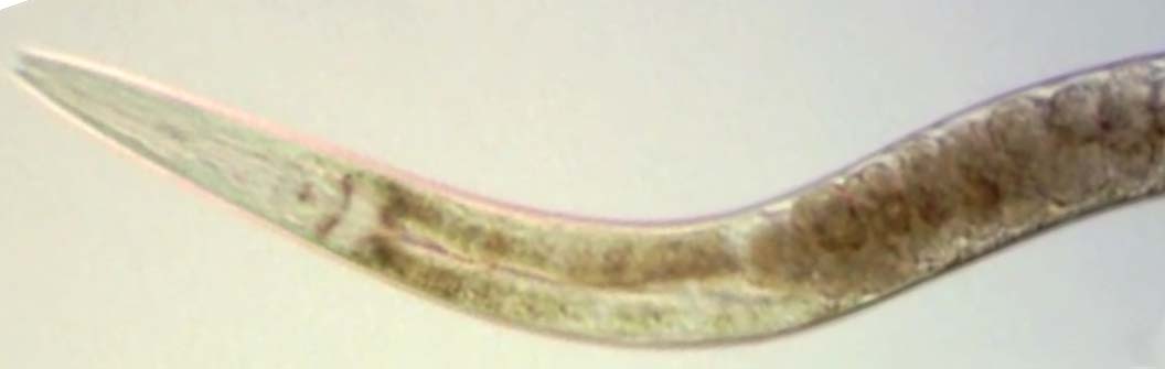 What can worms teach us about ourselves? | Fred Hutchinson Cancer Center